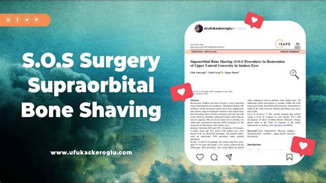 S O S Surgery Supraorbital Bone Shaving Youtube