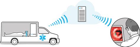 microwave imaging for brain stroke detection and monitoring using high