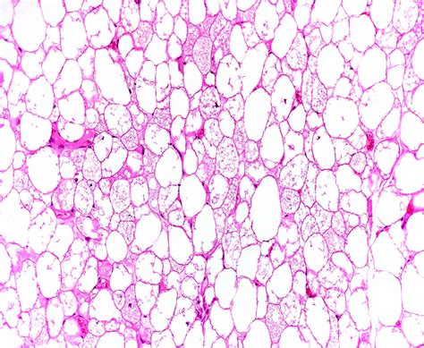 Pathology Outlines Histology