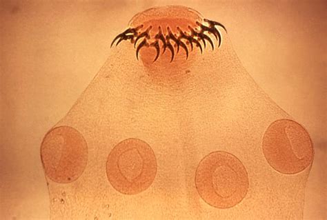 Cestodes Definition Classification And Characteristics