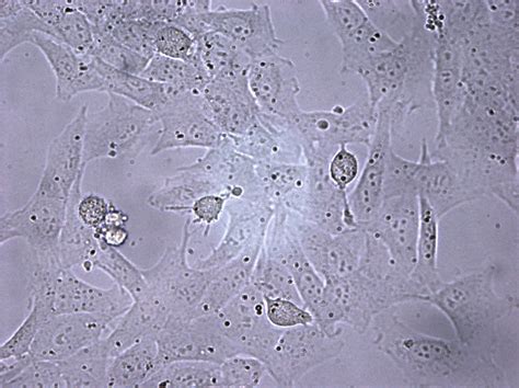 How To Induce Morphological Polarityaxondendrites In Drg Neurons In