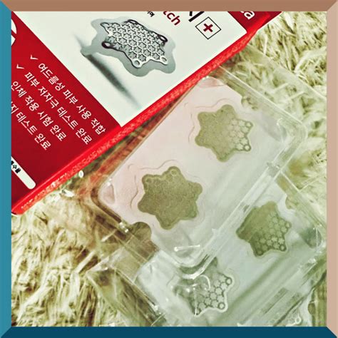 여드름 피부 리쥬란 관리방법 남자 로션 크림 네이버 블로그