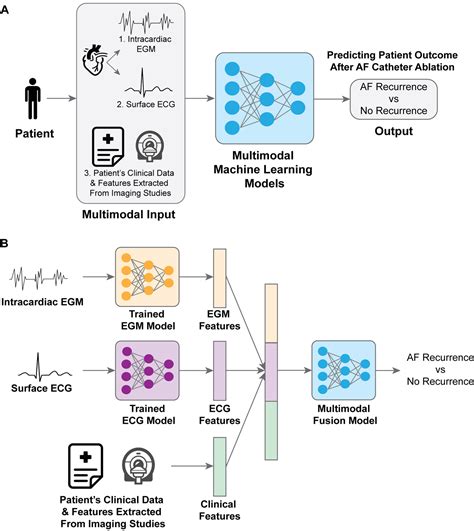 Machine Learning Enabled Multimodal Fusion Of Intra Atrial And Body Surface Signals In
