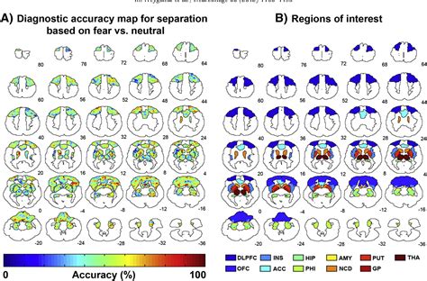 figure 4 from fmri pattern recognition in obsessive compulsive disorder