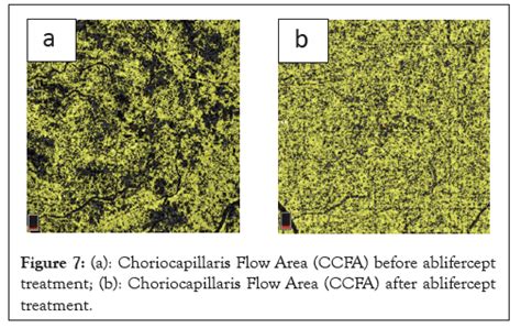 Evaluation Of Microcirculation Parameters In Optical Coherence To