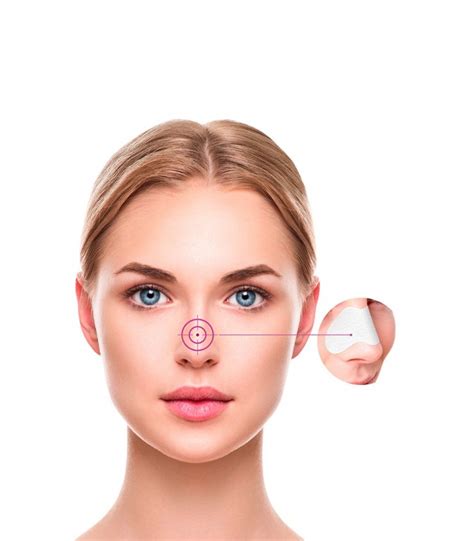 Lanaform Patch Purifiant Pour Le Nez Boutons Et Des Points Noirs Su