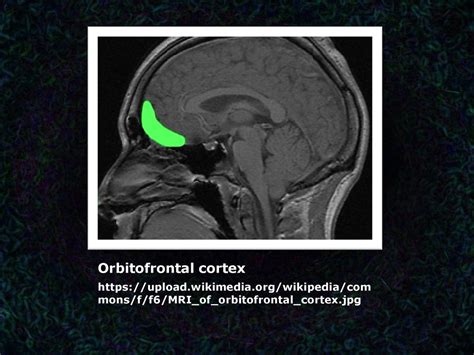 Mentalization Theory Of Mind And Autism Ppt Download