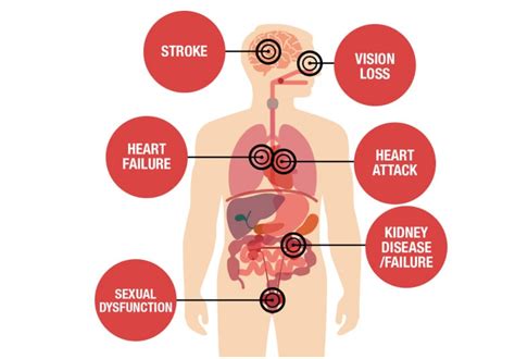 Why Is High Blood Pressure Bad Cardiologist Recommended Read