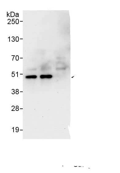 Bckdha Antibody Bsa Free Nbp3 29423 Novus Biologicals