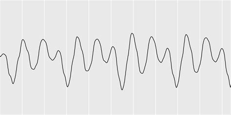 Waveform And Timbre Of Sound Using Mic Javalab
