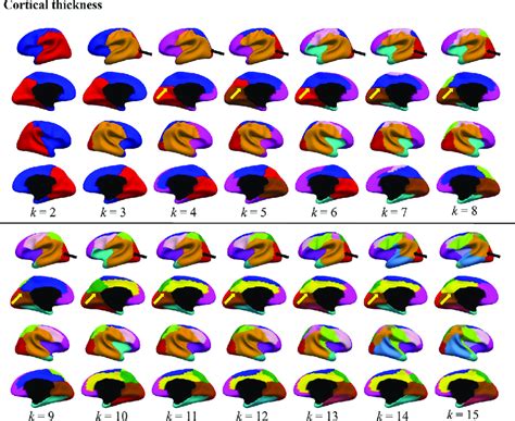 Genetic Parcellation Maps Of Ct On Both Left And Right Hemispheres Of