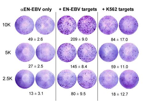 Granzyme B Grb Secretion By αen Ebv Ctl Cell Line In The Elispot