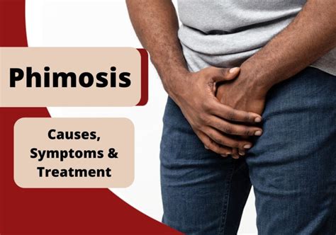 Phimosis Causes Symptoms And Treatment Urolife Clinic