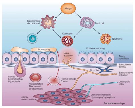 7 Schematic Representation Of Asthma Pathophysiology Several Download Scientific Diagram