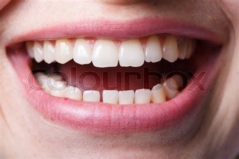 Dentistry, dental , mouth and teeth ... | Stock image | Colourbox