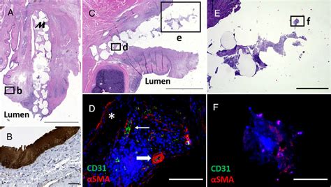 Postmortem Histological Assessment Of The Implanted Construct By Site
