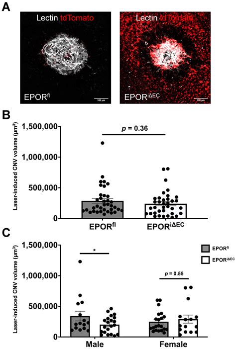 Epor Knockout In Endothelial Cells Reduced Laser Induced Cnv In Male