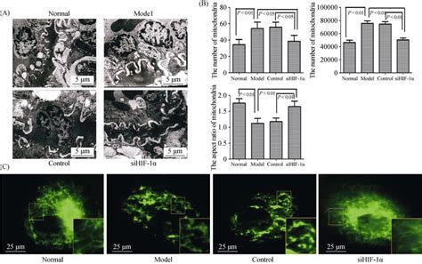 The Morphology Of Mitochondria Under Hypoxia Is Dependent On Hif 1α In Download Scientific
