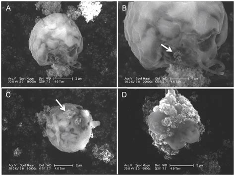 Scanning Electron Micrographs Showing Interaction Of Aggregated Download Scientific Diagram