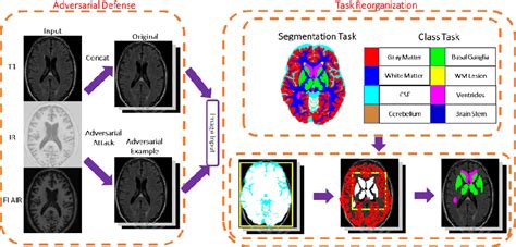 Brain Mr Image Segmentation In Small Dataset With Adversarial Defense