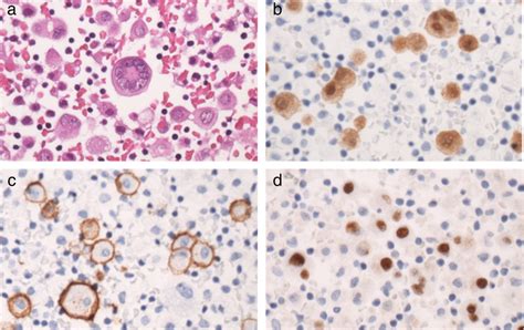 Hematoxylin And Eosin He And Immunohistochemistry Ihc Staining Of Download Scientific