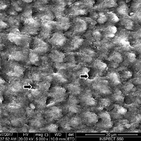 Scanning Electron Micrograph High Magnification ×5000 Of Dentin