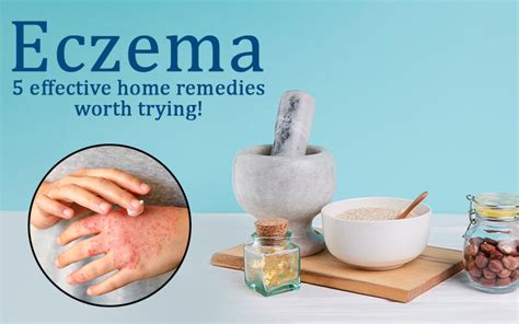 Eczema 5 Effective Home Remedies Worth Trying