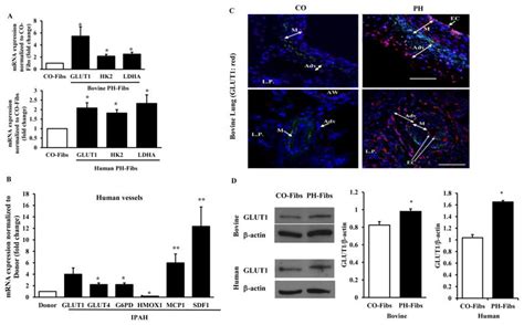 Metabolic Reprogramming Regulates The Proliferative And Inflammatory