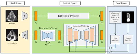 논문 리뷰 Vision Language Synthetic Data Enhances Echocardiography