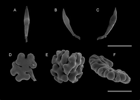 Scanning Electron Micrograph Of Microconidia And Macroconidia Download Scientific Diagram