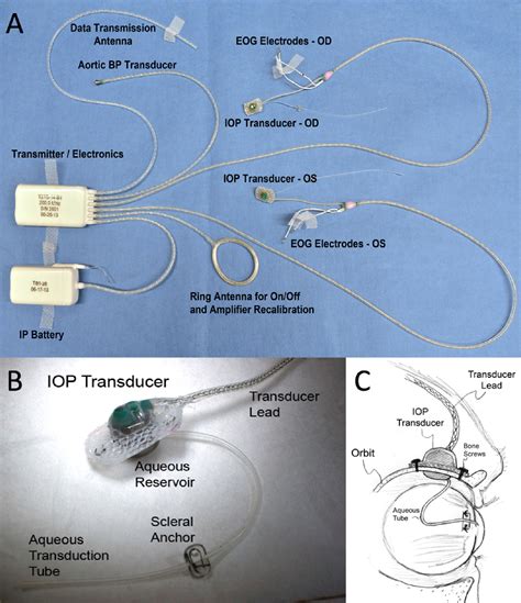 Figure 1 From Intra Subject Variability And Diurnal Cycle Of Ocular