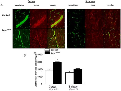 Astrocytic Structural Alterations Are Prominent In The Cortex Of
