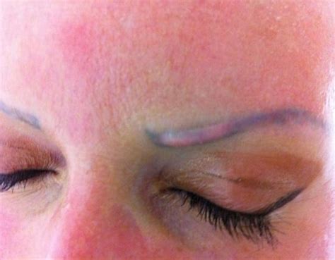 Keloid Permanent Makeup Saubhaya Makeup