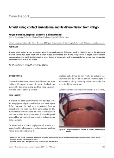 Pdf Amulet String Contact Leukoderma And Its Differentiation From Vitiligo