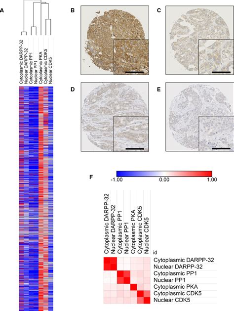 Heat Map Of Darpp‐32 Pp1 Pka And Cdk5 Expression A Representative Download Scientific