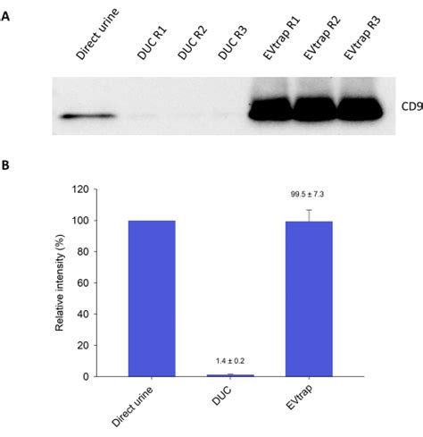 Chemical Affinity Based Isolation Of Extracellular Vesicles From Biofluids For Proteomics And