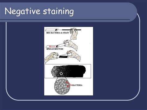 Ppt Staining Powerpoint Presentation Free Download Id342041