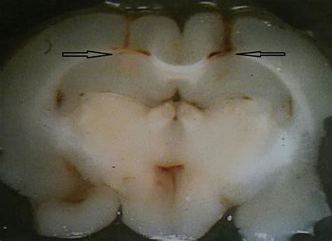 Figure1 Photomicrograph Of Rat Brain Section Indicating The Site Of