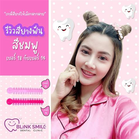 คลินิกทันตกรรม Blink Smile ศูนย์ทันตกรรมครบวงจร ฟิวเจอร์พาร์ครังสิต