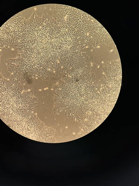 How Does The Ipscs Look Rlabrats