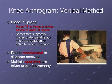 Ppt Arthrography Powerpoint Presentation Free Download Id6876867