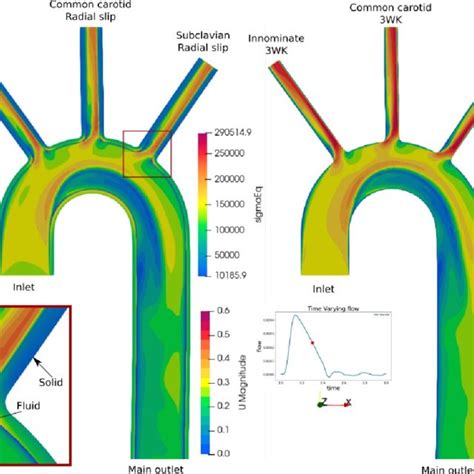 comparison between velocity fields obtained with fsi left and cfd