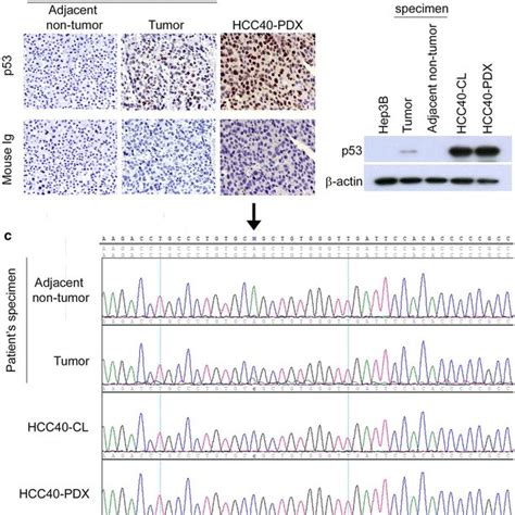 tp53 mutational analysis in original tumor and adjacent non tumor liver