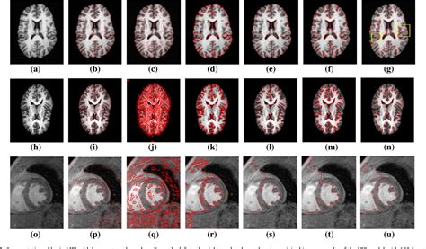Figure 1 From A Robust Patch Statistical Active Contour Model For Image Segmentation Semantic