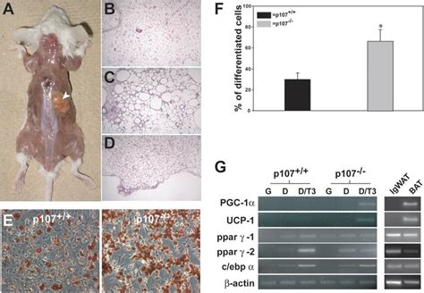 Adult Preadipocytes Lacking P107 Display An In Vivo Differentiation Download Scientific Diagram