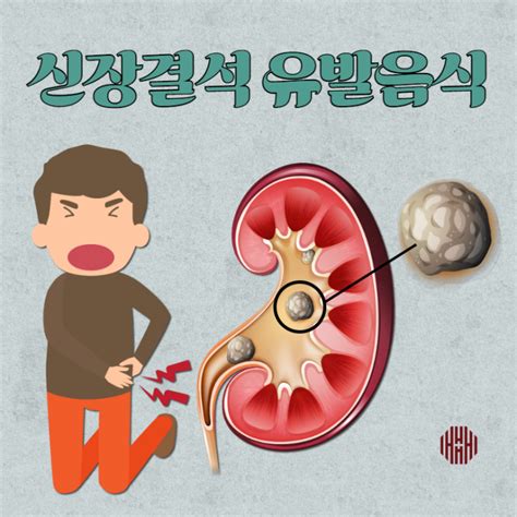 신장결석 요로결석 원인이 되는 음식 5가지 결석을 예방하는 식습관은 네이버 블로그