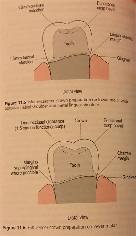 Have A Little Class Kennedy Classifications Artofit