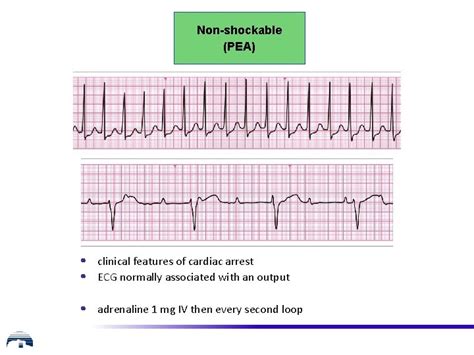 Als Algorithm Learning Outcomes This Lecture Should Enable