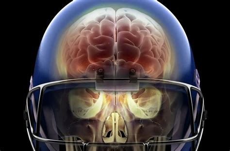 12 Facts About Cte