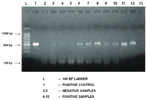 Figure Reverse Transcriptase Polymerase Chain Reaction For Dengue
